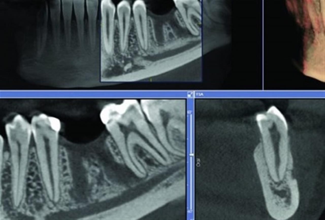 Level One CBCT Training | Cavendish Imaging