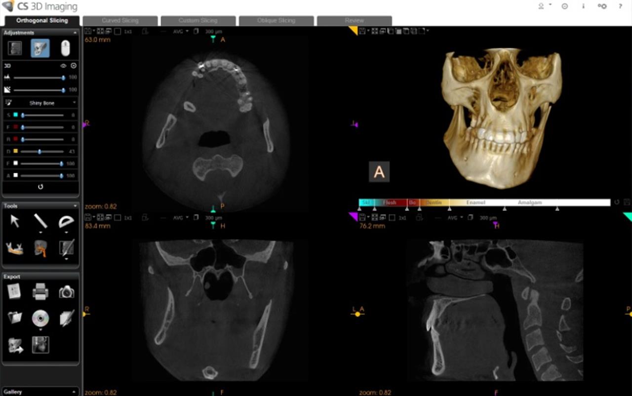 Carestream Software Tutorial | Cavendish Imaging