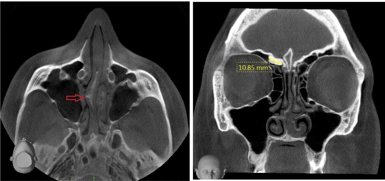 3D Imaging for ENT | Cavendish Imaging