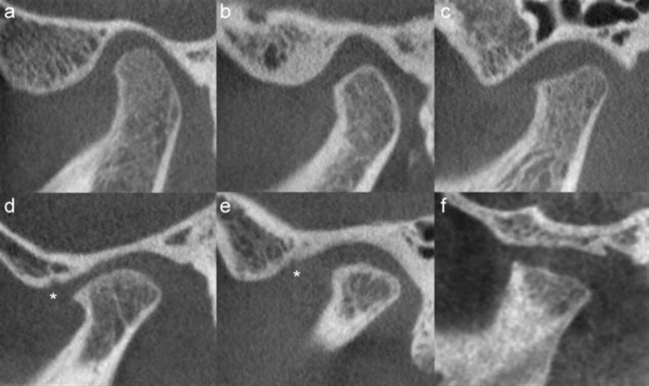 CBCT and the TMJ | Cavendish Imaging
