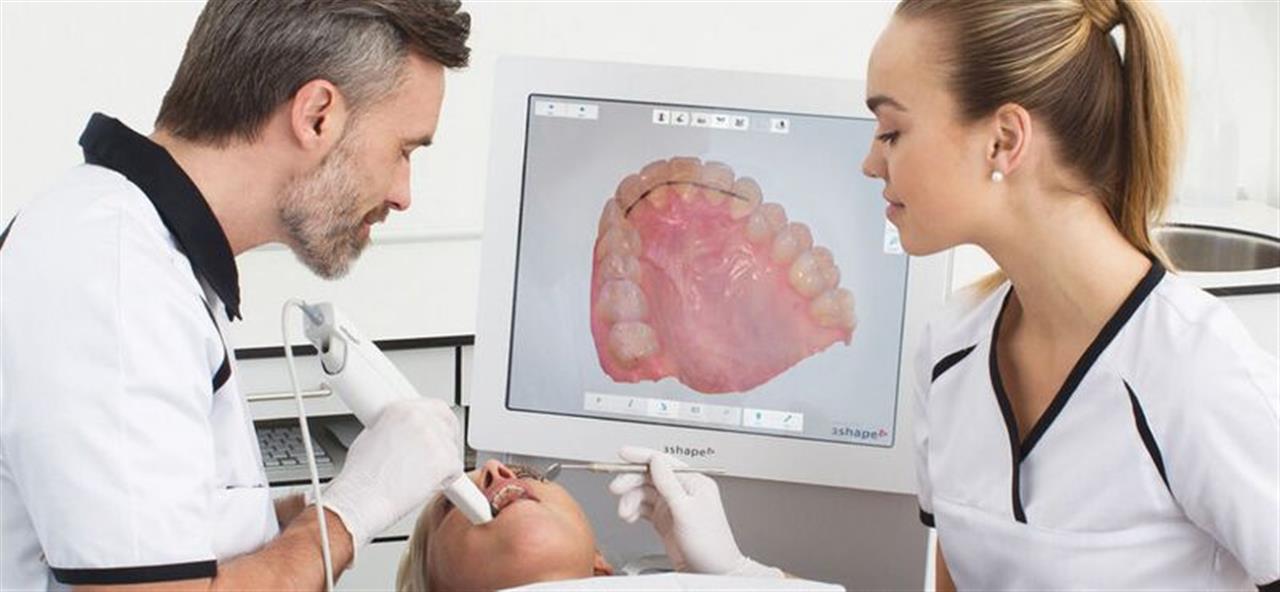The Benefits of Intra-Oral Scanning | Cavendish Imaging