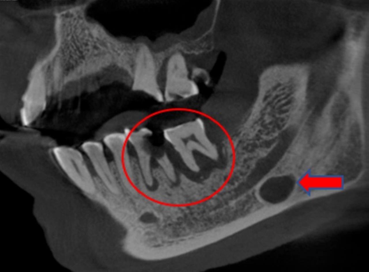CBCT Interpretation of Diseased Anatomy | Cavendish Imaging